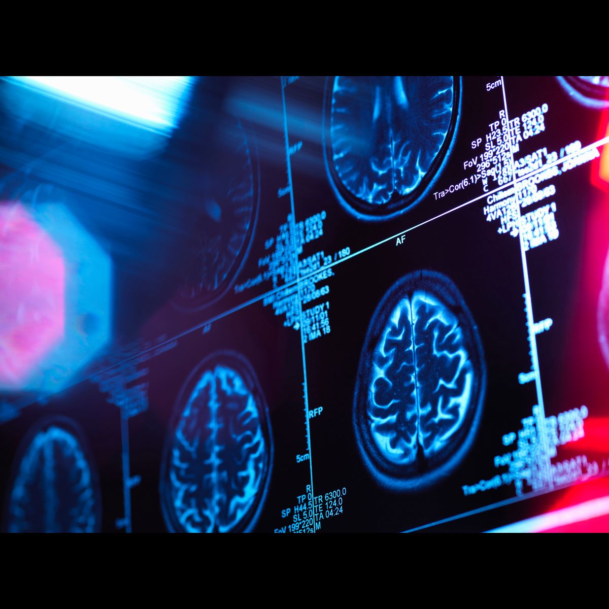 Enhanced level practice in radiography - Busting the myths.