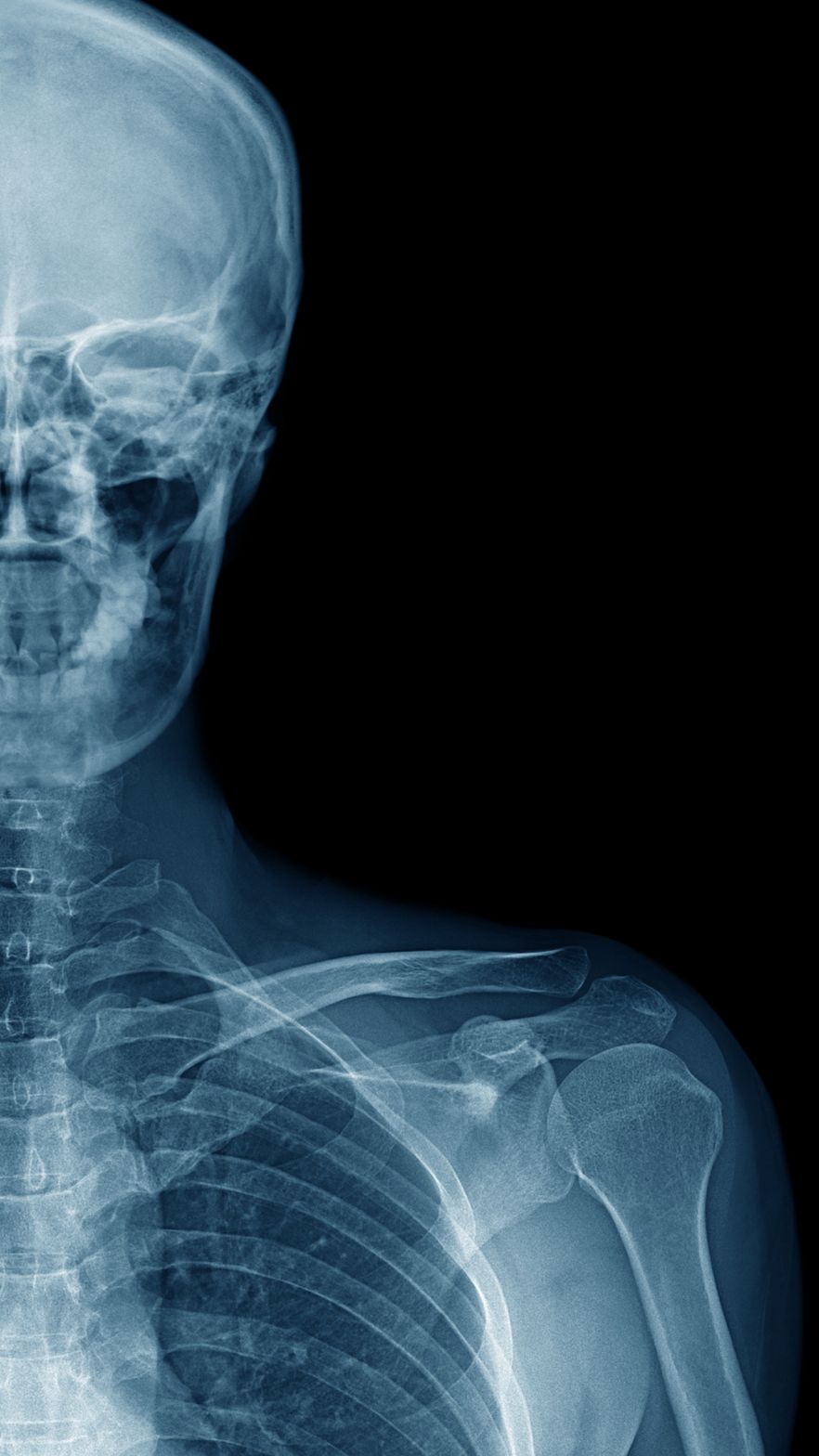 World Radiography Day